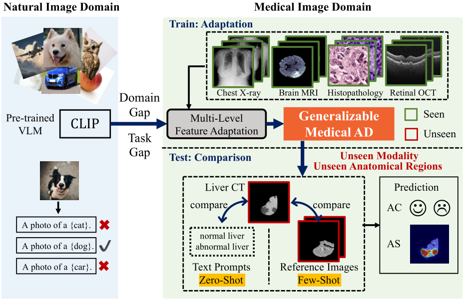 Adapting Visual-Language Models for Generalizable Anomaly Detection in ...