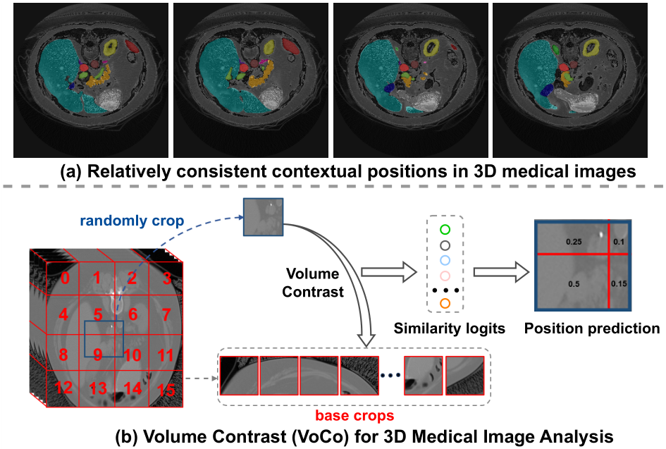 VoCo: A Simple-yet-Effective Volume Contrastive Learning Framework for 3D Medical Image Analysis ...